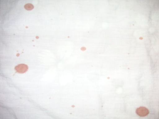 All About Your Child » Blog Archive » Blood Sprinkles